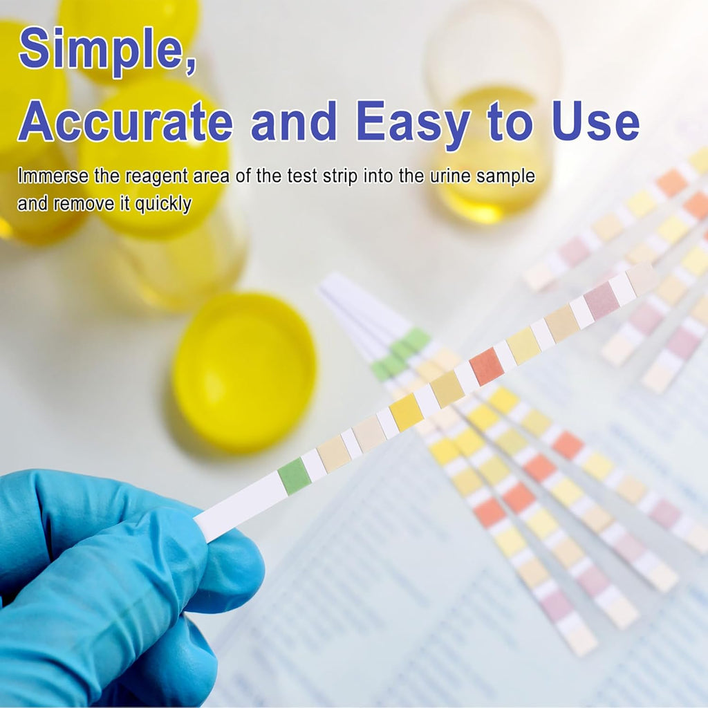 Urinalysis Test Strips – 10 Parameter Home Urine Test Kit | 100 Strips ...